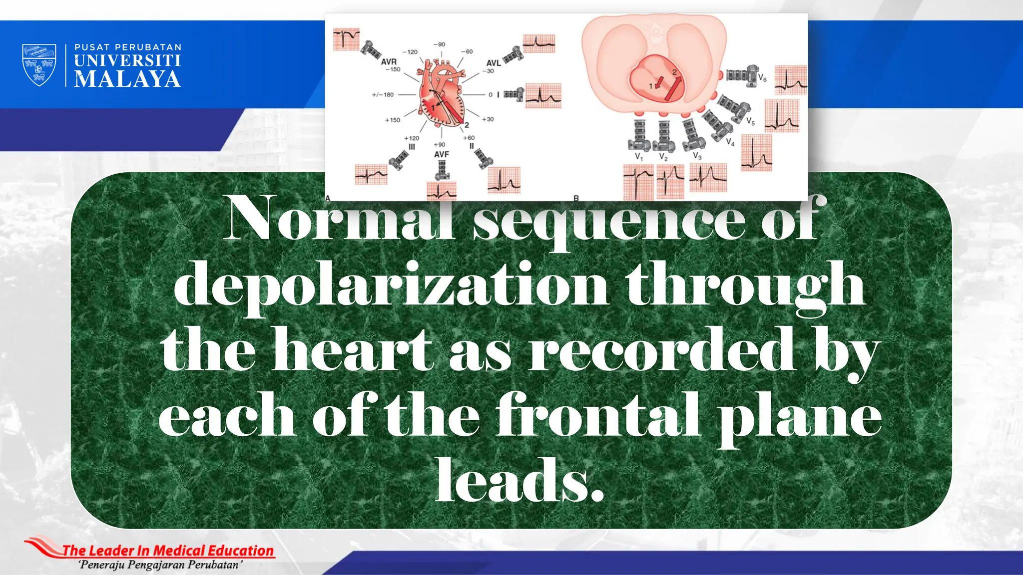 12 LEAD ECG INTERPRETATION nursing in critical care | PPT