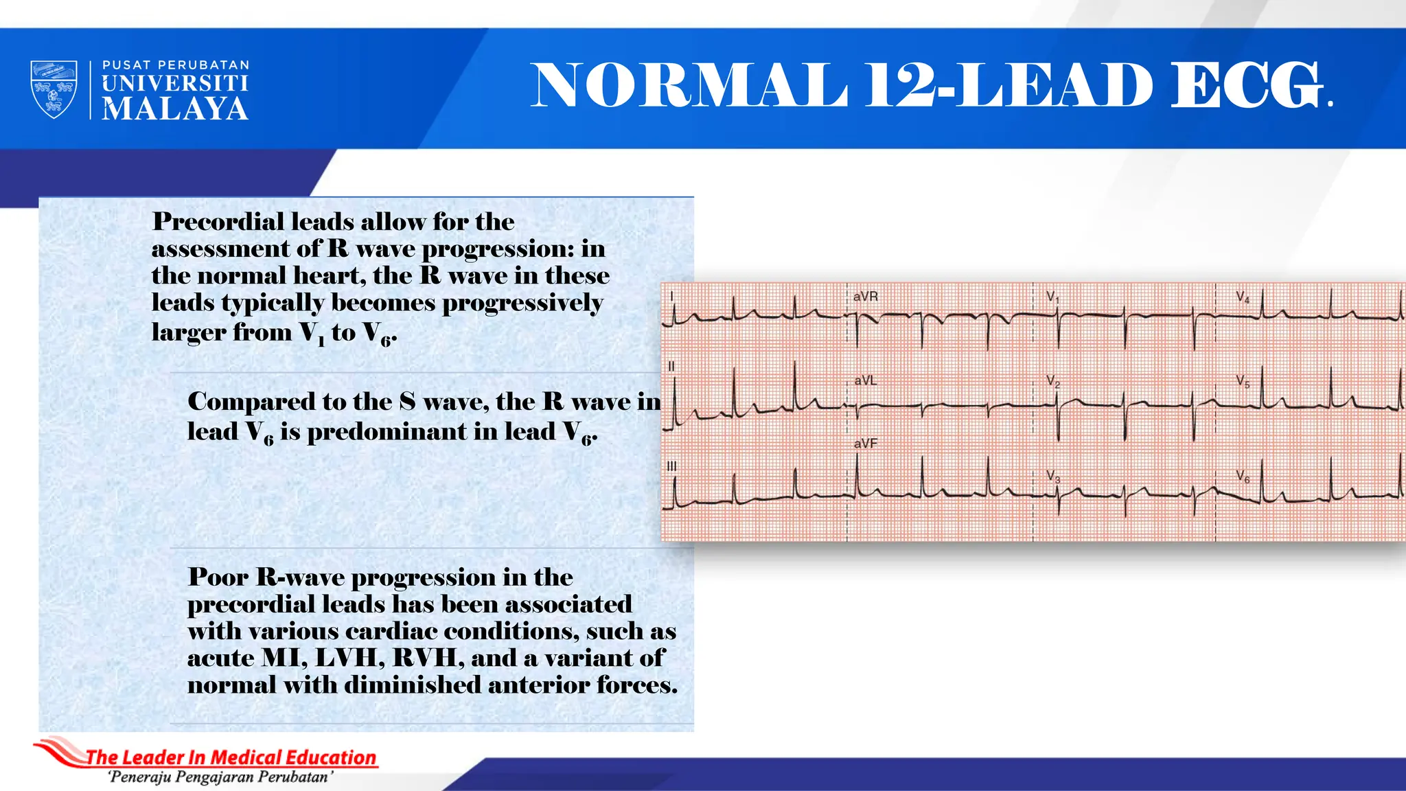 12 LEAD ECG INTERPRETATION nursing in critical care | PPT