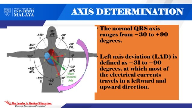 12 LEAD ECG INTERPRETATION nursing in critical care | PPT