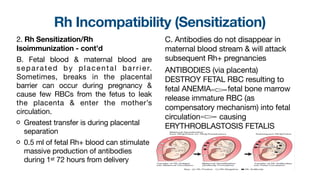 3.1. Hemolytic Dse- Rh Sensitization ABO.pdf