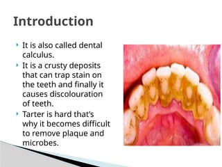 3. Tarter Tartar, also known as dental calculus, is a hardened form of dental plaque that forms ...
