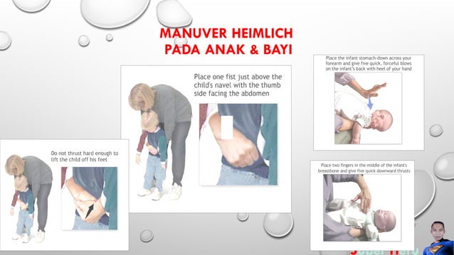 3. BANTUAN HIDUP DASAR.pptx................. | PPTX