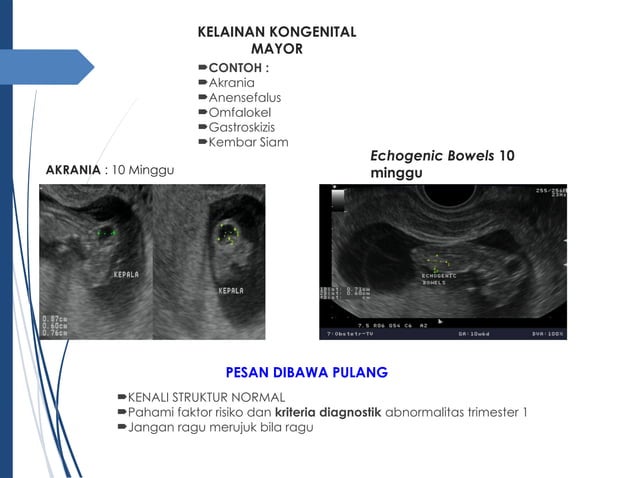 3.e USG Obstetri trimester 1 patologi 2.pptx