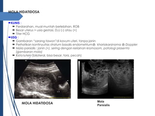 3.e USG Obstetri trimester 1 patologi 2.pptx
