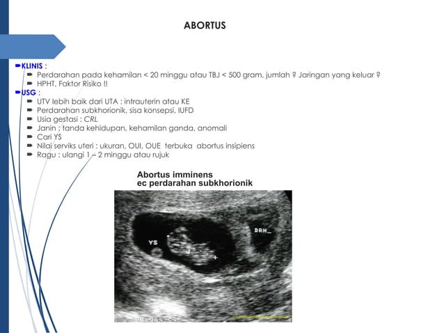 3.e USG Obstetri trimester 1 patologi 2.pptx