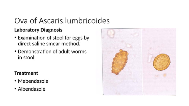 Human Intestinal Nematode Infections.pptx
