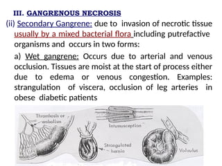 3. necrosis.pptxnecrosis .necrosistype of pathology | PPTX