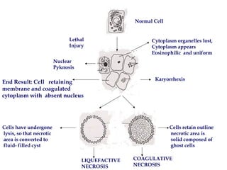 3. necrosis.pptxnecrosis .necrosistype of pathology | PPTX