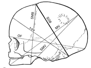 Anatomy of female pelvis and fetal skull.GYN OBS.pptx