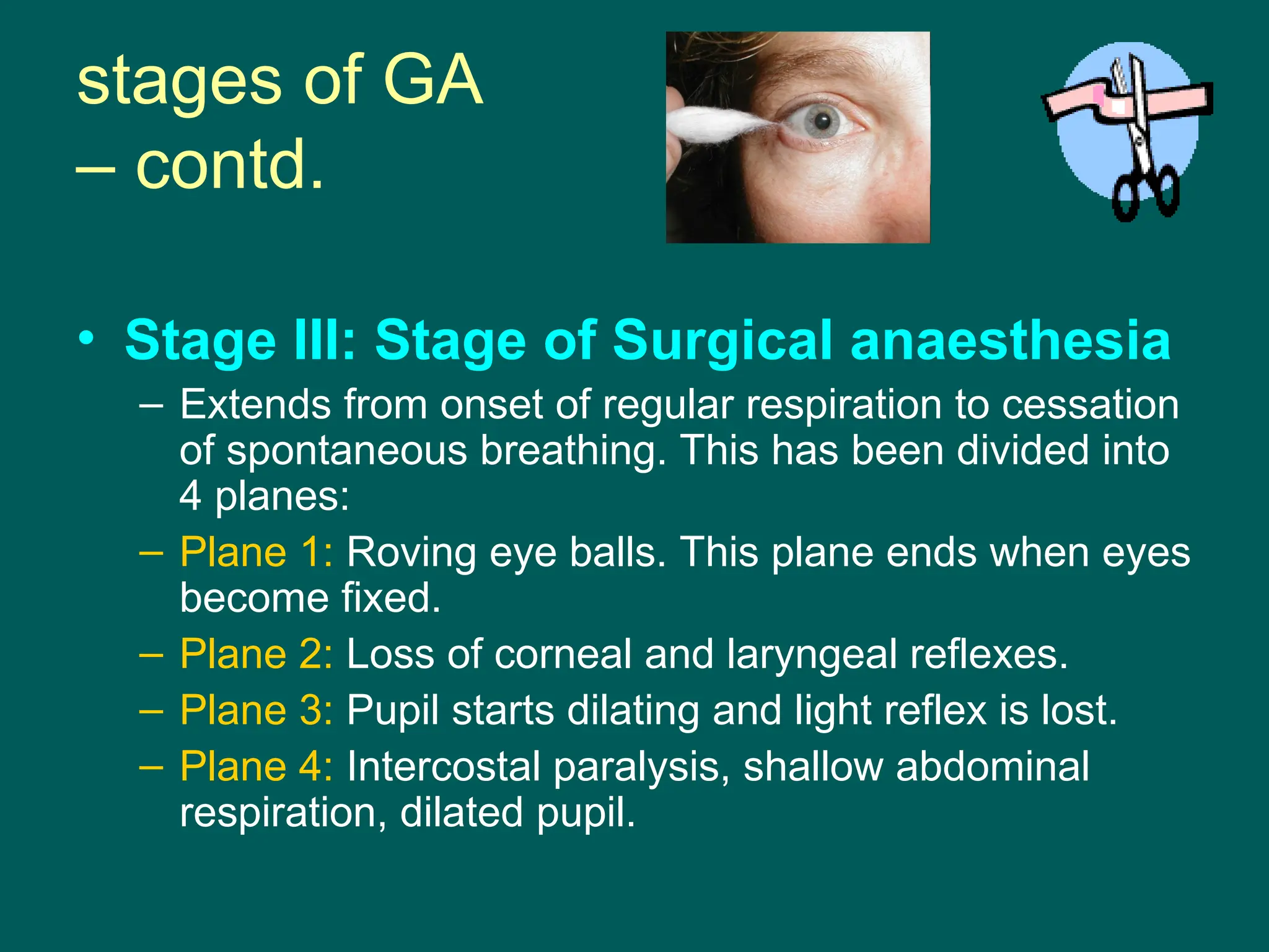 Pharmacholocy lecture and class 3 General anaesthesia.ppt