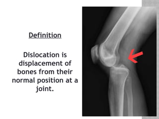 first aid management of injuries and fracture | PPTX
