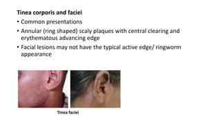 Comprehensive Overview of Common Skin Diseases and Their Management | PDF