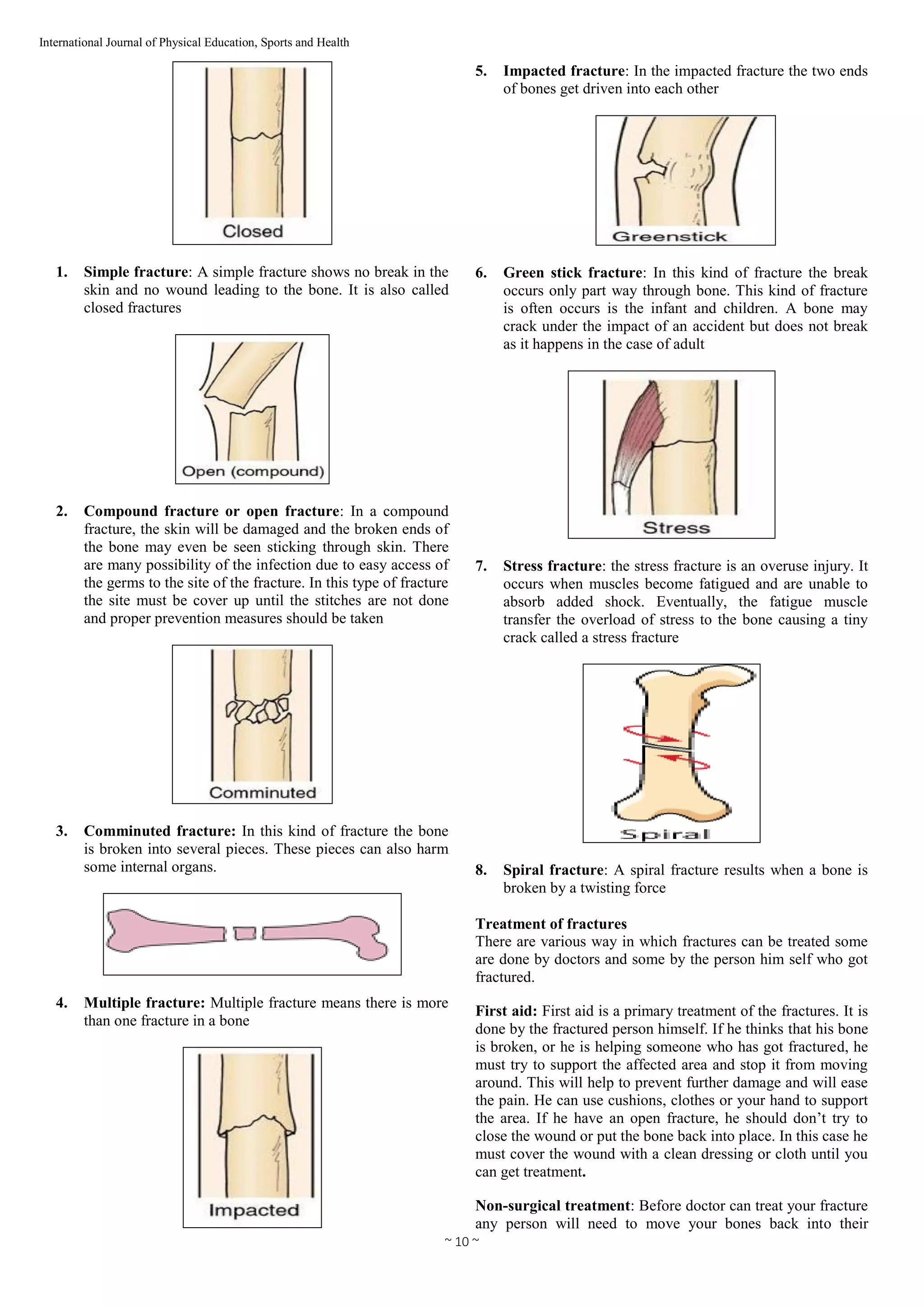 Sports injury - Fractures | PDF