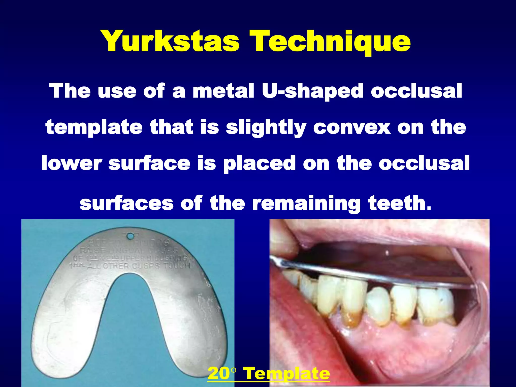 3 a. management of maxillary and mandibular single complete dentures | PPT