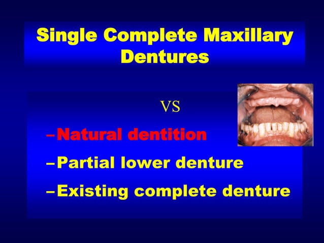 3 a. management of maxillary and mandibular single complete dentures | PPT