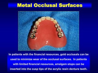 3 a. management of maxillary and mandibular single complete dentures | PPT