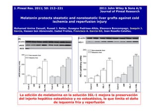 Perspectivas de la preservación de órganos para trasplante. Francisco ...