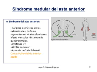 SINDROMES NEUROLÓGICOS - I Sd. PIRAMIDAL - NEURONA MOTORA SUPERIOR | PDF