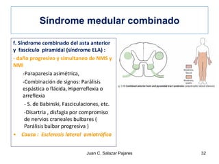 SINDROMES NEUROLÓGICOS - I Sd. PIRAMIDAL - NEURONA MOTORA SUPERIOR | PDF