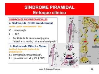 síndromes neurológicos 1 síndrome piramidal | PDF