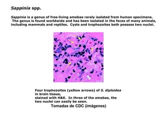 amebas de vida libre, amebas | PPT