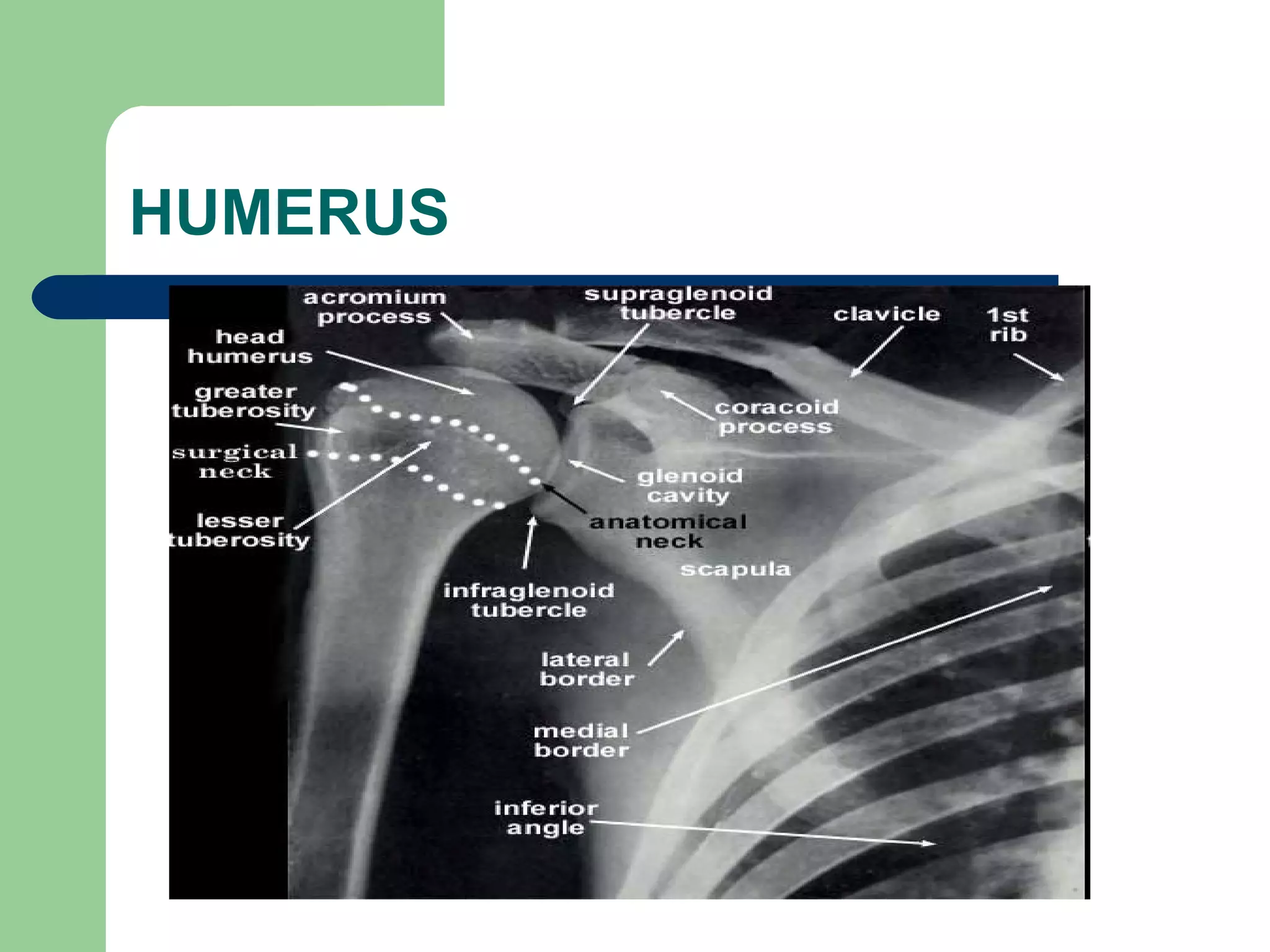 3. anastomosis around the surgical neck of humerus[1] | PPT