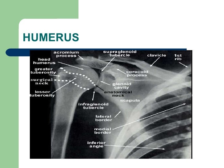 3. anastomosis around the surgical neck of humerus[1]