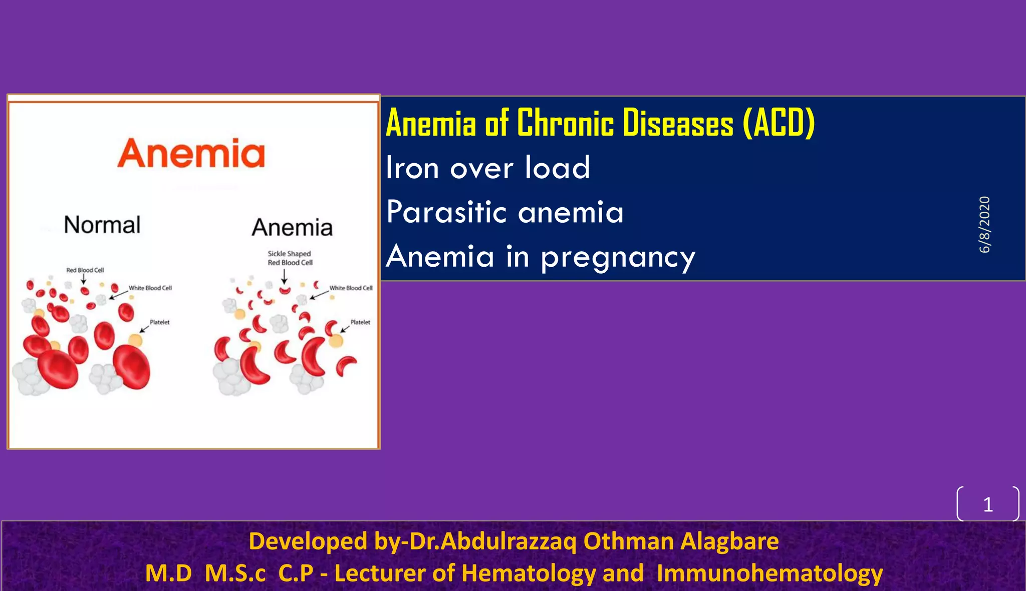 3 anemia of chronic diseases (acd) ,iron overload | PPT