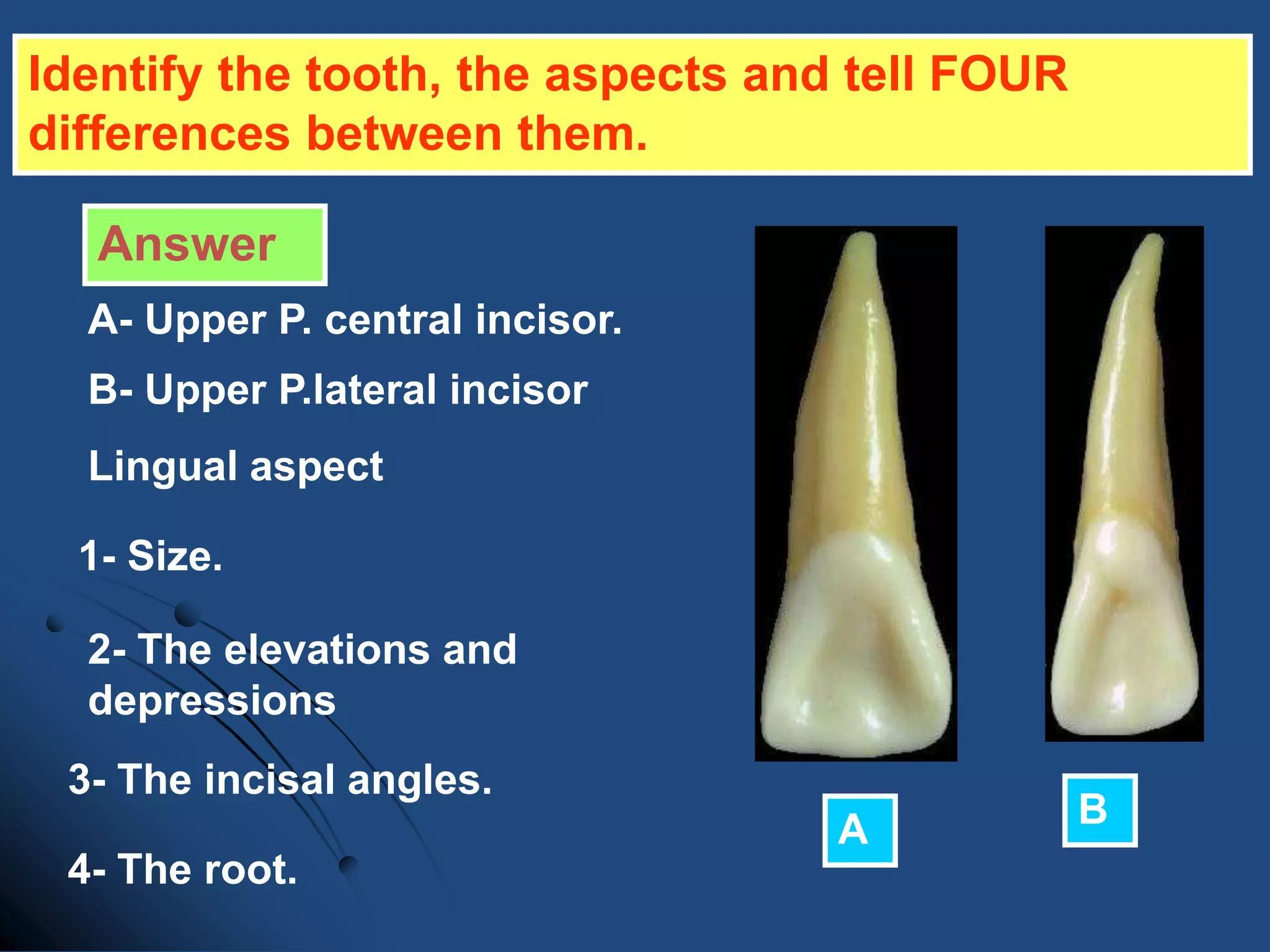 Anterior tooth | PPTX