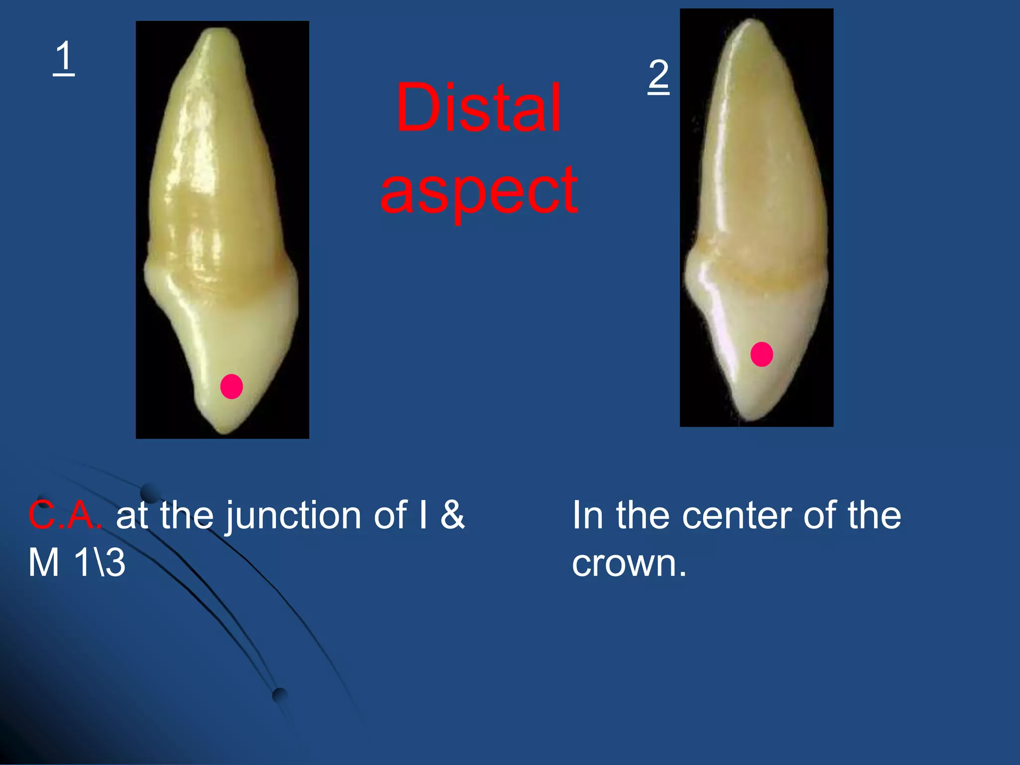 Anterior tooth | PPTX