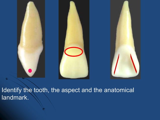 Anterior tooth | PPTX