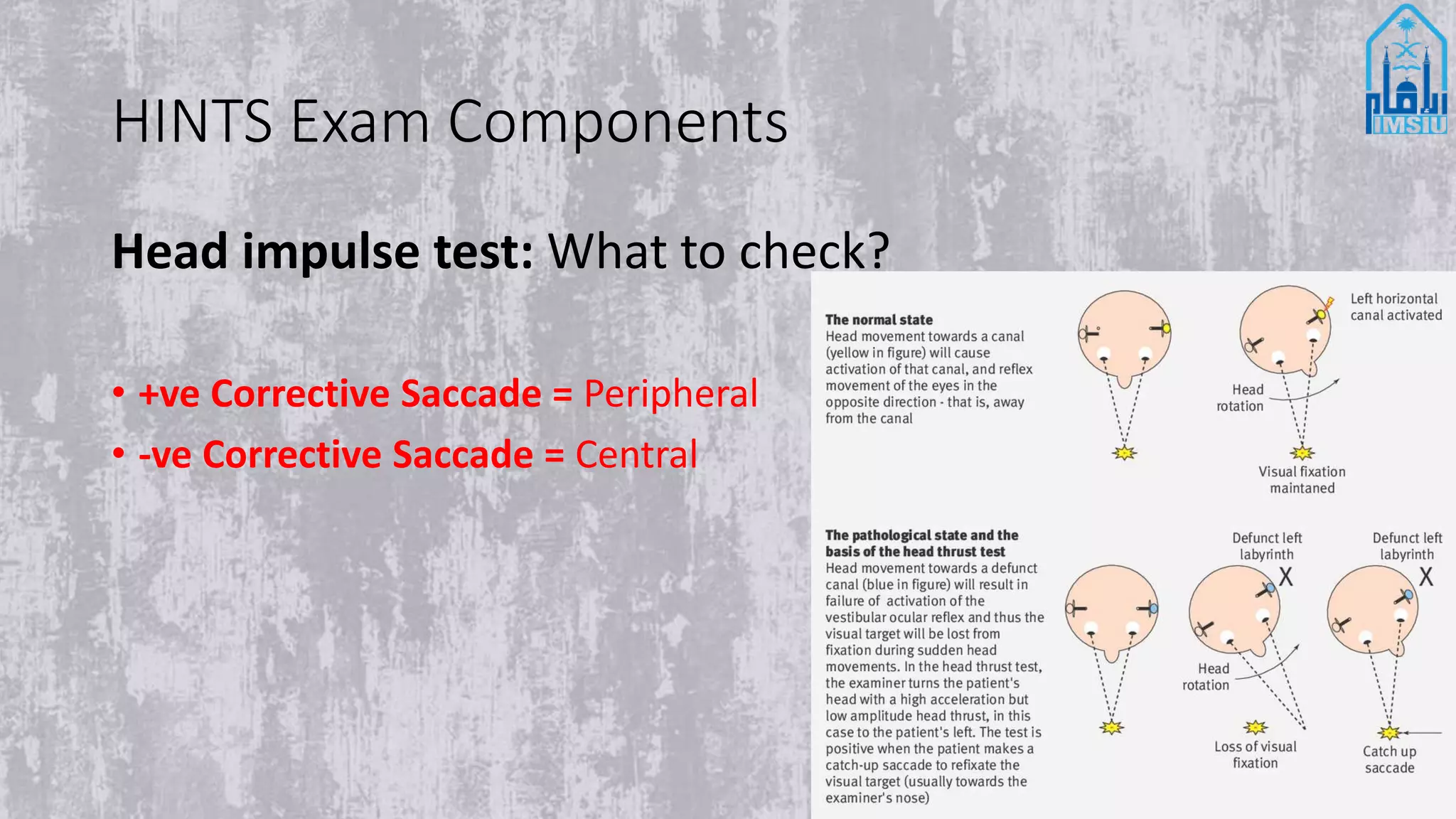 Approach to dizziness | PPTX