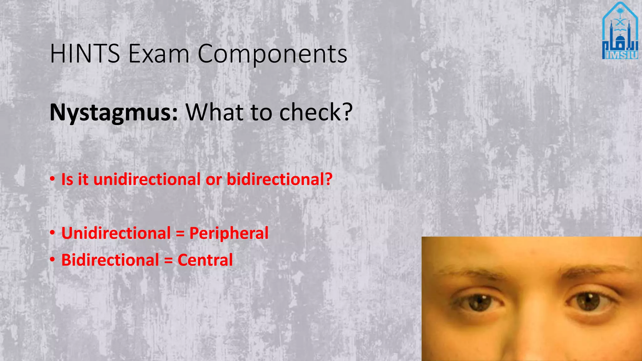 Approach to dizziness | PPTX