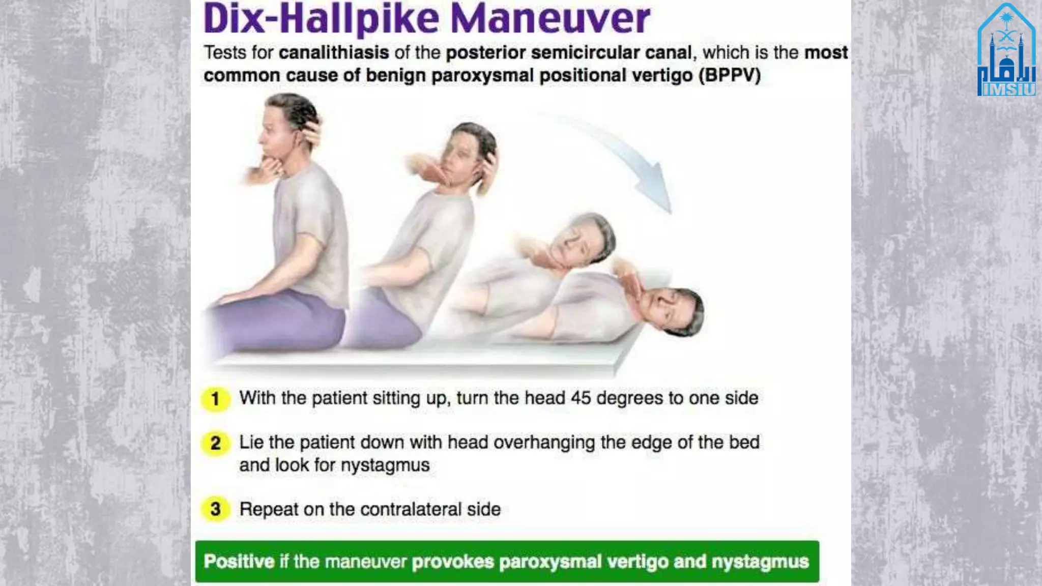 Approach to dizziness | PPTX