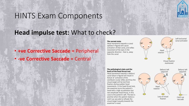 Approach to dizziness | PPTX | Brain and Nervous System Disorders ...