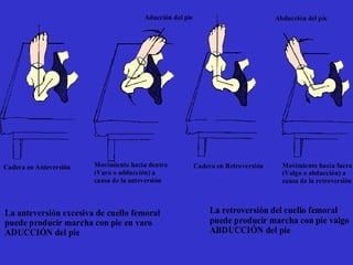 Articulacion de la cadera con radiológica y perthes | PPT