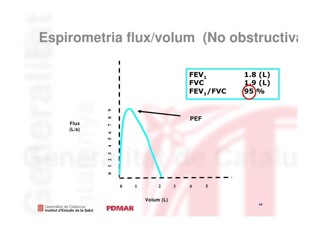 3 aspectes bàsics de l'espirometria