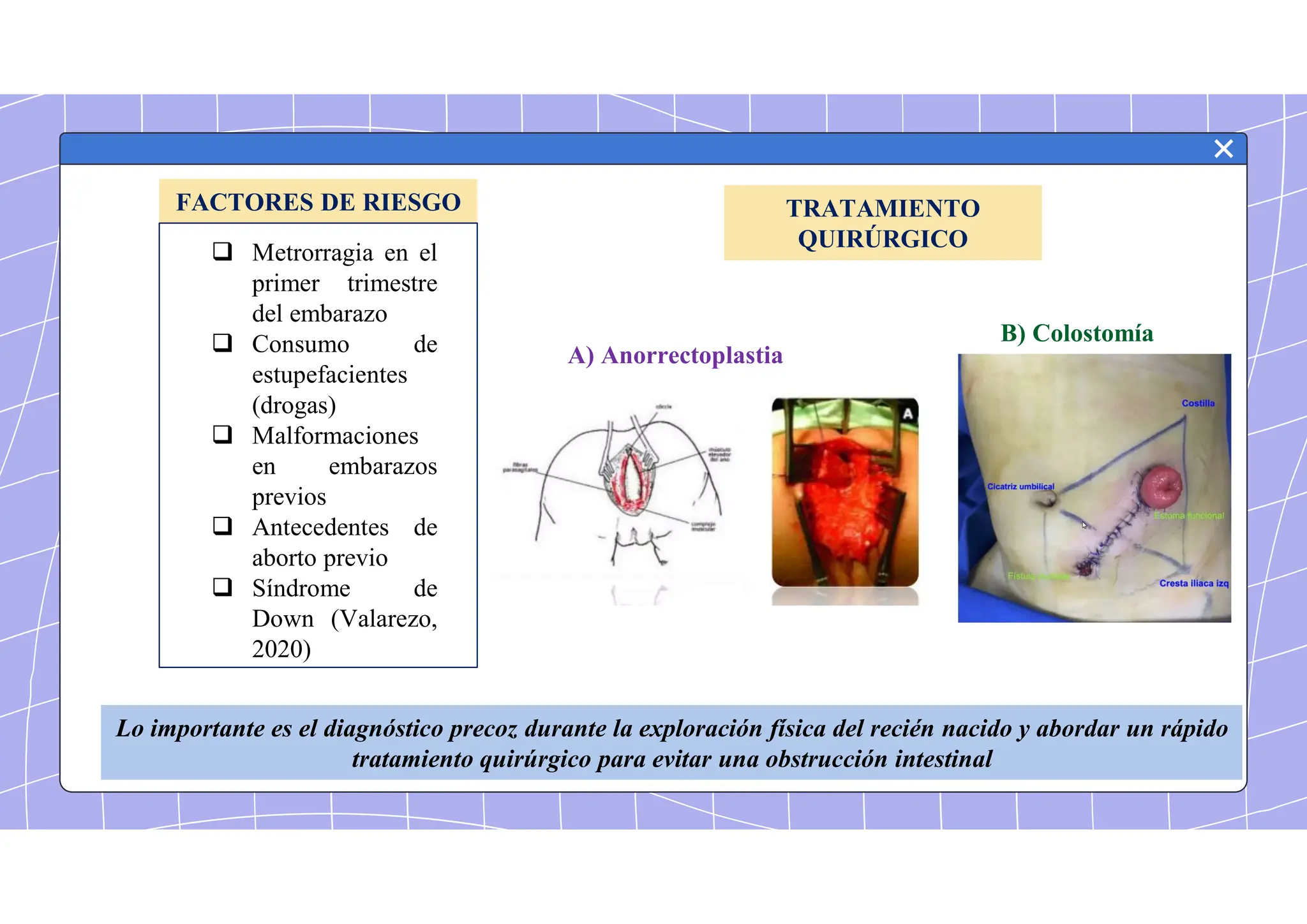 3°-ATRESIA ANAL, FISTULA RECTOPERINEAL Y ANO IMPERFORADO (1).pdf