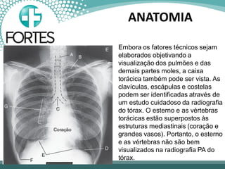 3 - AULA ANATOMIA DO TÓRAX, ABDOME e PELVE.pdf