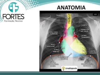 3 - AULA ANATOMIA DO TÓRAX, ABDOME e PELVE.pdf
