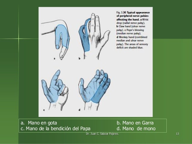 3 b-grandes-sindromes i-nmi-2016-1_