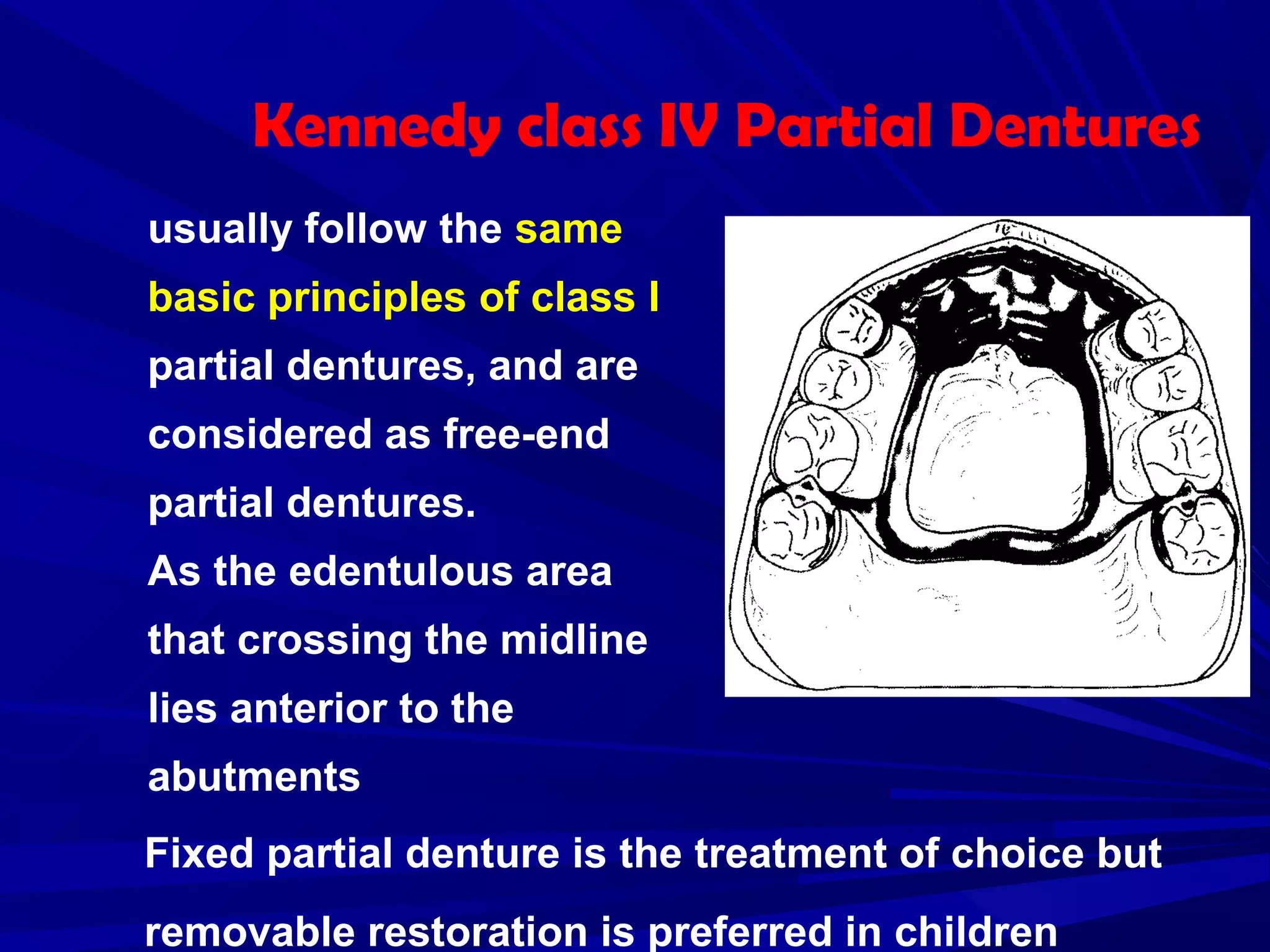 3 basic principles for designing class ii and iii and iv | PPT