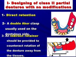 3 basic principles for designing class ii and iii and iv | PPT