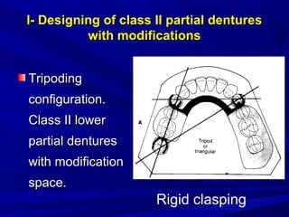 3 basic principles for designing class ii and iii and iv | PPT