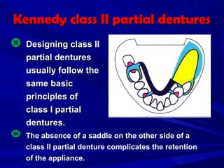 3 basic principles for designing class ii and iii and iv | PPT