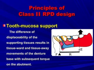 3 basic principles for designing class ii and iii and iv | PPT