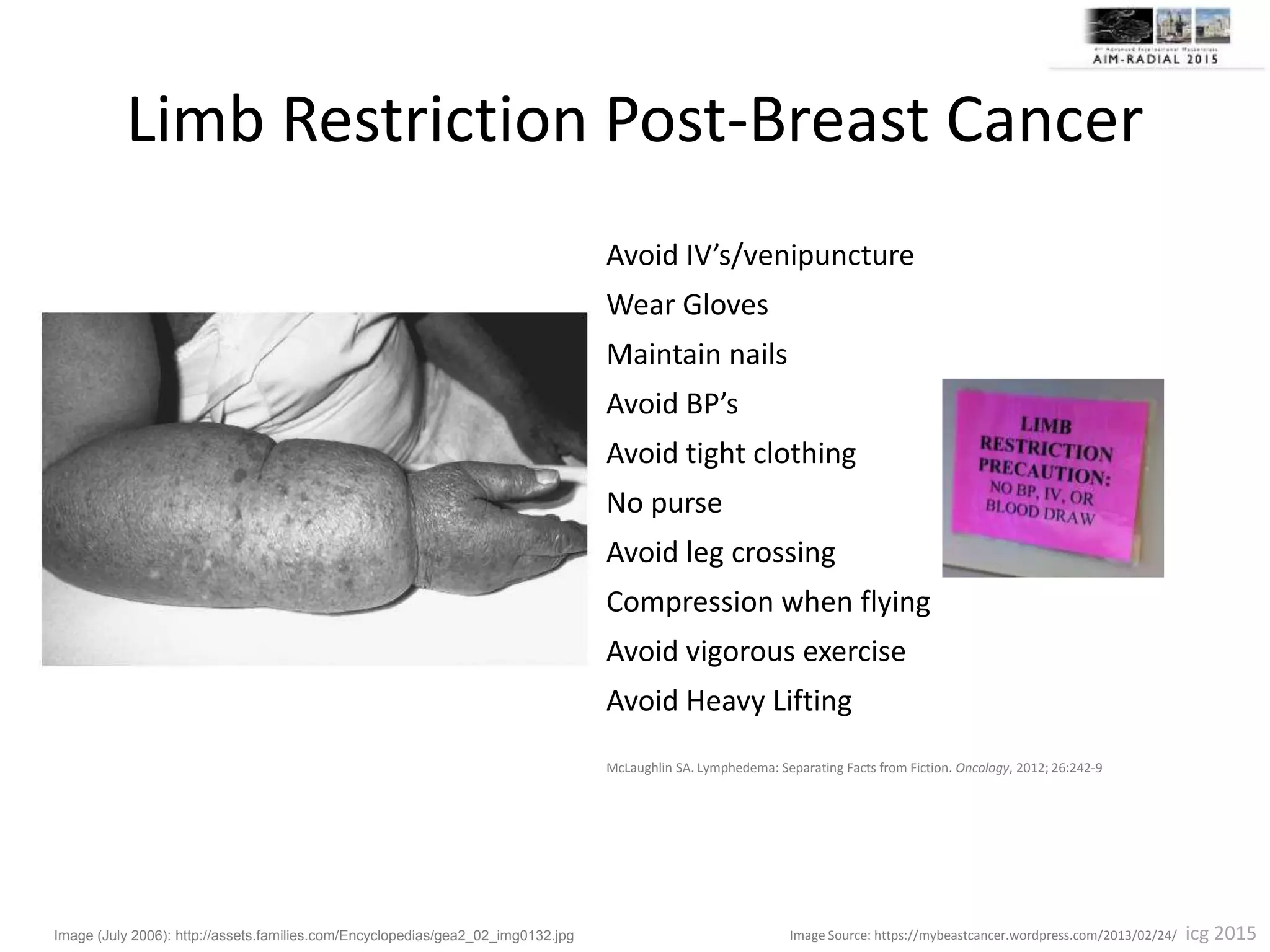 Gilchrist IC - AIMRADIAL 2015 - Transradial in breast cancer | PPTX ...
