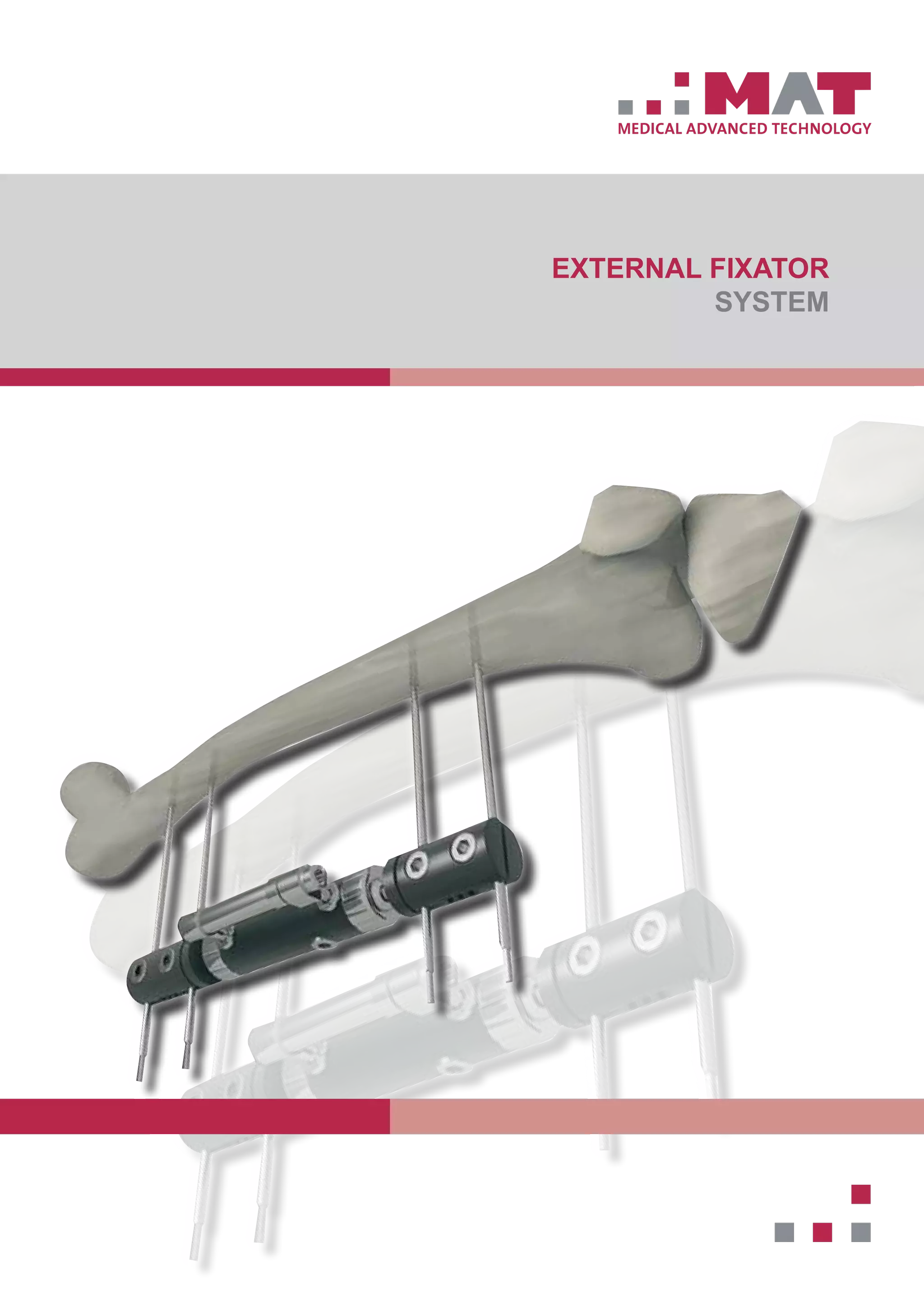 3 brochure external-fixators | PDF | Bone and Joint Conditions ...