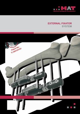 3 brochure external-fixators | PDF | Bone and Joint Conditions ...