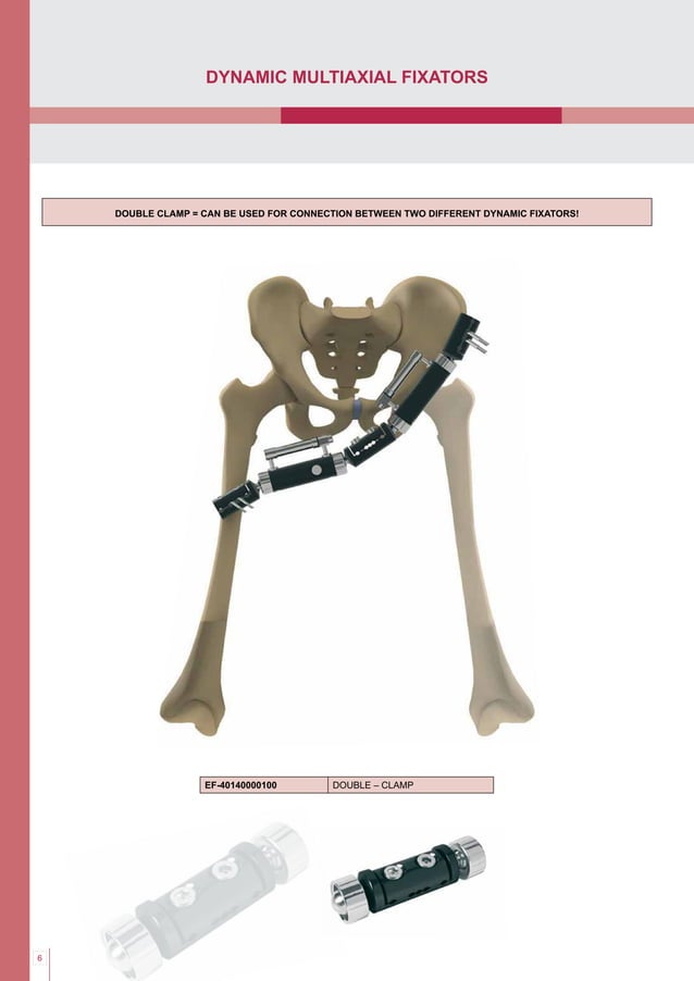 3 brochure external-fixators | PDF | Bone and Joint Conditions ...